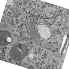 Cisterna ambiens - DocCheck Flexikon