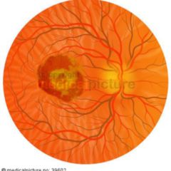 Augenhintergrund - DocCheck Flexikon