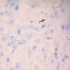 Mycobacterium gordonae - DocCheck Flexikon
