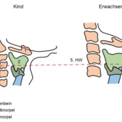 Kindernotfall - DocCheck Flexikon