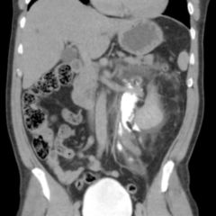 Urinom - DocCheck Flexikon