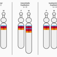 Dup15q-Syndrom - DocCheck Flexikon