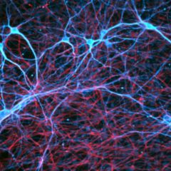 GFAP - DocCheck Flexikon