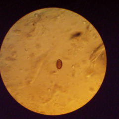 Trichuris vulpis - DocCheck Flexikon