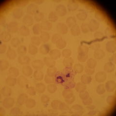 Blutausstrich - DocCheck Flexikon