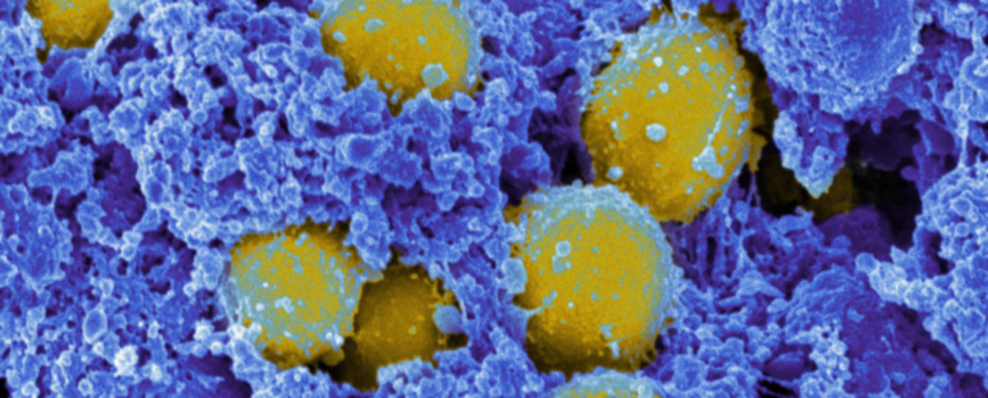 Immunsystem: Staphylococcus aureus mit List - DocCheck