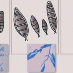 Saprophyt - DocCheck Flexikon