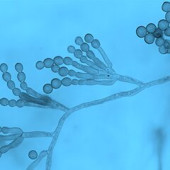 Scopulariopsis brevicaulis - DocCheck Flexikon