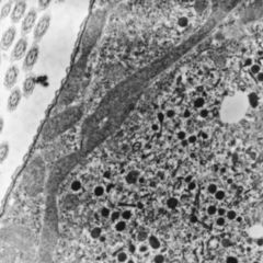 Endosom - DocCheck Flexikon