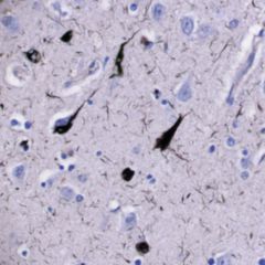 Neurofibrille - DocCheck Flexikon