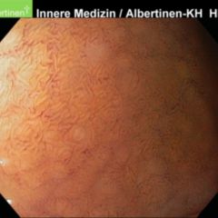 Zotte - DocCheck Flexikon