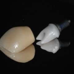 Vollkrone - DocCheck Flexikon