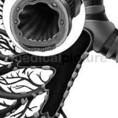 Bronchialsystem - DocCheck Flexikon