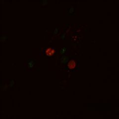 Punctum maximum - DocCheck Flexikon