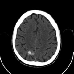 Nativ - DocCheck Flexikon