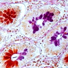 Lieberkühn-Krypten - DocCheck Flexikon