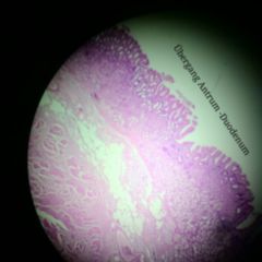 Pylorus - DocCheck Flexikon