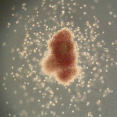 Große Furche - DocCheck Flexikon