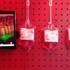 Cancer en cuirasse - DocCheck Flexikon