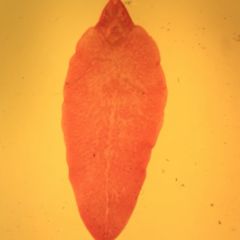 Arteria hepatica propria - DocCheck Flexikon