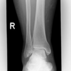 Re-Staging - DocCheck Flexikon