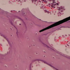 Osteoblast - DocCheck Flexikon
