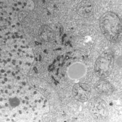 Phagolysosom - DocCheck Flexikon