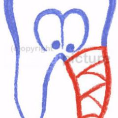 Pulpitis - DocCheck Flexikon