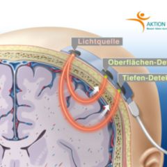 Lebenserwartung Bei Hypoxischem Hirnschaden