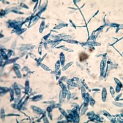 Dermatophyt - DocCheck Flexikon