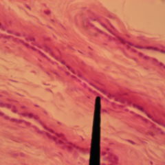 Plicae transversales recti - DocCheck Flexikon