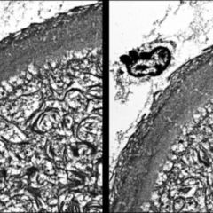 Intermediate metabolizer - DocCheck Flexikon