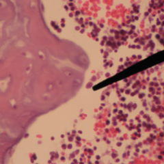 Plasmazelle - DocCheck Flexikon