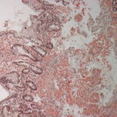 Kongorot - DocCheck Flexikon