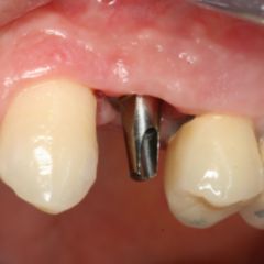 Chromosom 14 - DocCheck Flexikon