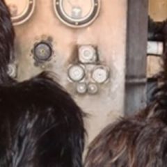 Savary-Miller-Klassifikation - DocCheck Flexikon