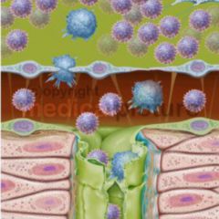 Nodus - DocCheck Flexikon