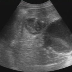 Lobus - DocCheck Flexikon