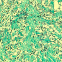 Stroma - DocCheck Flexikon