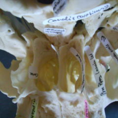 Choane - DocCheck Flexikon