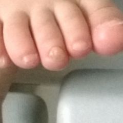 Tetrazepam - DocCheck Flexikon