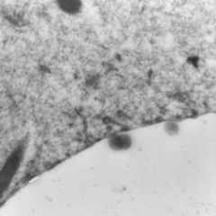 Phagolysosom - DocCheck Flexikon