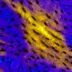 Spongiosa - DocCheck Flexikon
