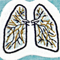 Pulmonale Infiltration - DocCheck Flexikon