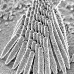 Kent-Bündel - DocCheck Flexikon