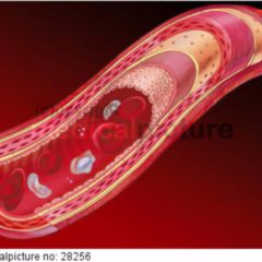 Membrana tectoria - DocCheck Flexikon