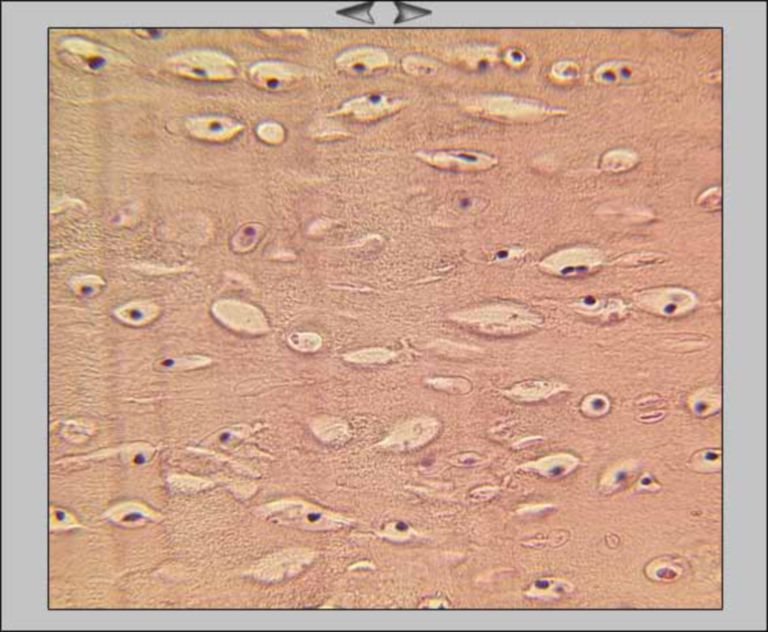 Faserknorpel 20x II - DocCheck