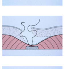 Proktologie - DocCheck Flexikon