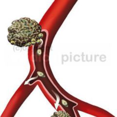 Hämatogen - DocCheck Flexikon