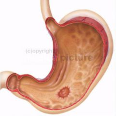 Incisura angularis ventriculi - DocCheck Flexikon
